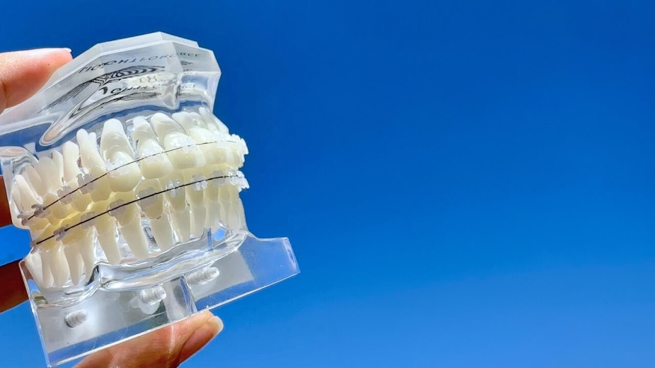 LightForce Ceramic Braces: Fully Custom 3D-Printed Braces - Lincoln ...